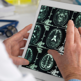 Home | Alzheimer's Disease International (ADI)