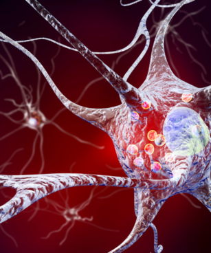 Dementia facts & figures | Alzheimer's Disease International (ADI)