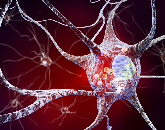 Dementia facts & figures | Alzheimer's Disease International (ADI)